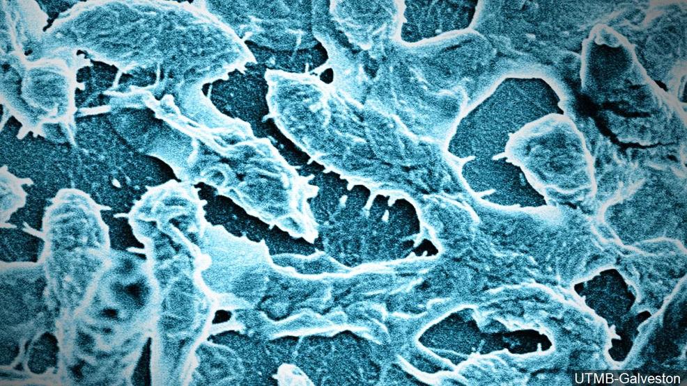 Flesh Eating Bacteria Attacks Florida Mans Buttocks After Swim In The