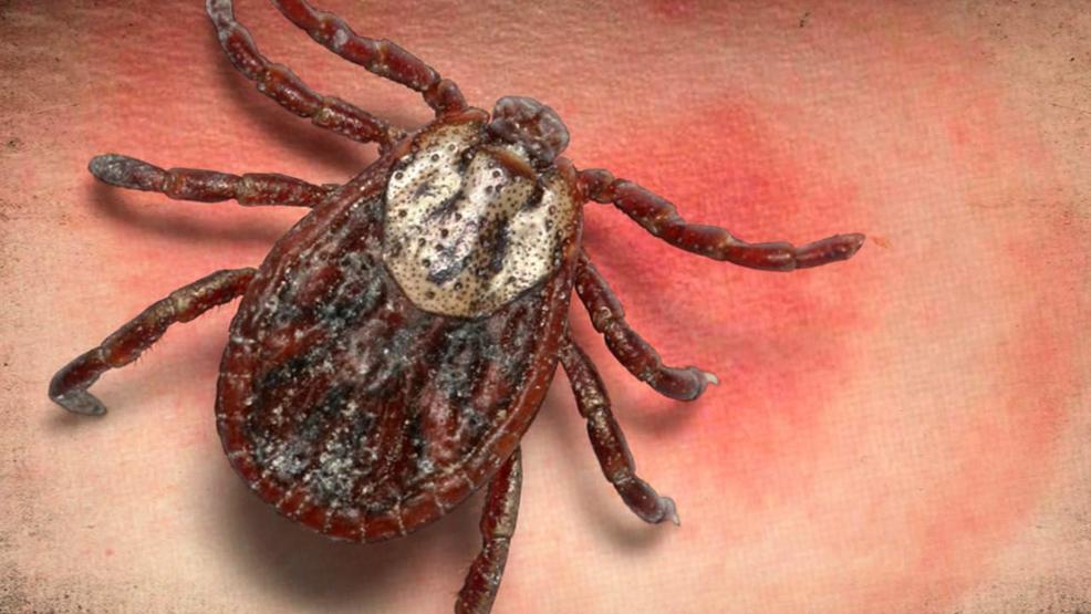 Veterinarians warn about bad tick season in CNY | WSTM